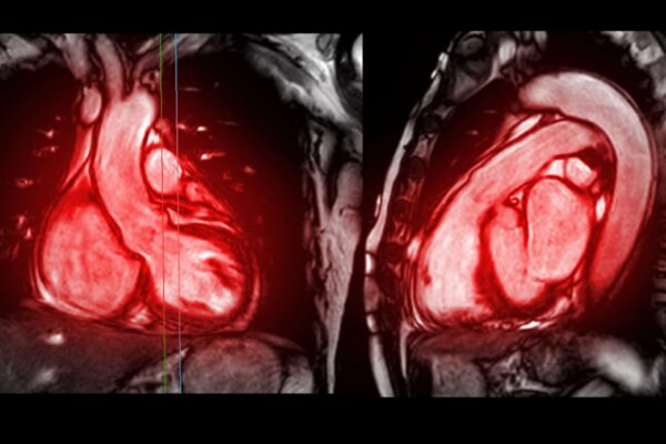 What 100,000 heart, brain and body scans teach us about ageing - UK Biobank